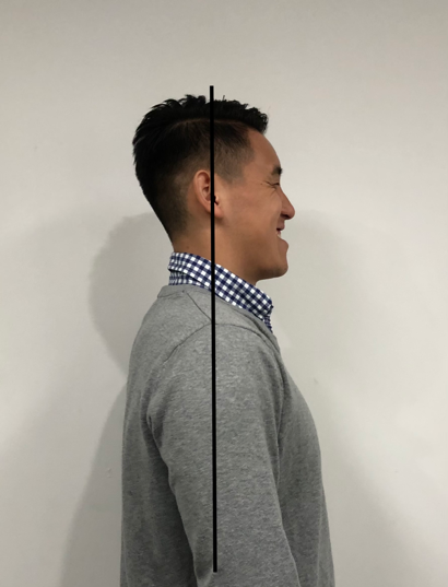 Forward Head Posture & Text Neck – Quay Health