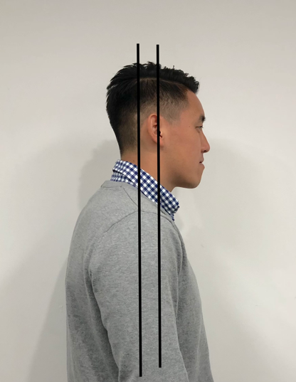 Forward Head Posture & Text Neck – Quay Health